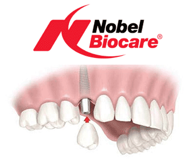 Nowe Zęby: Piękny uśmiech w jeden dzień